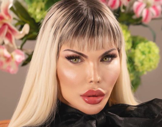 Human Ken Doll is No Longer a Man - EDM Chicago