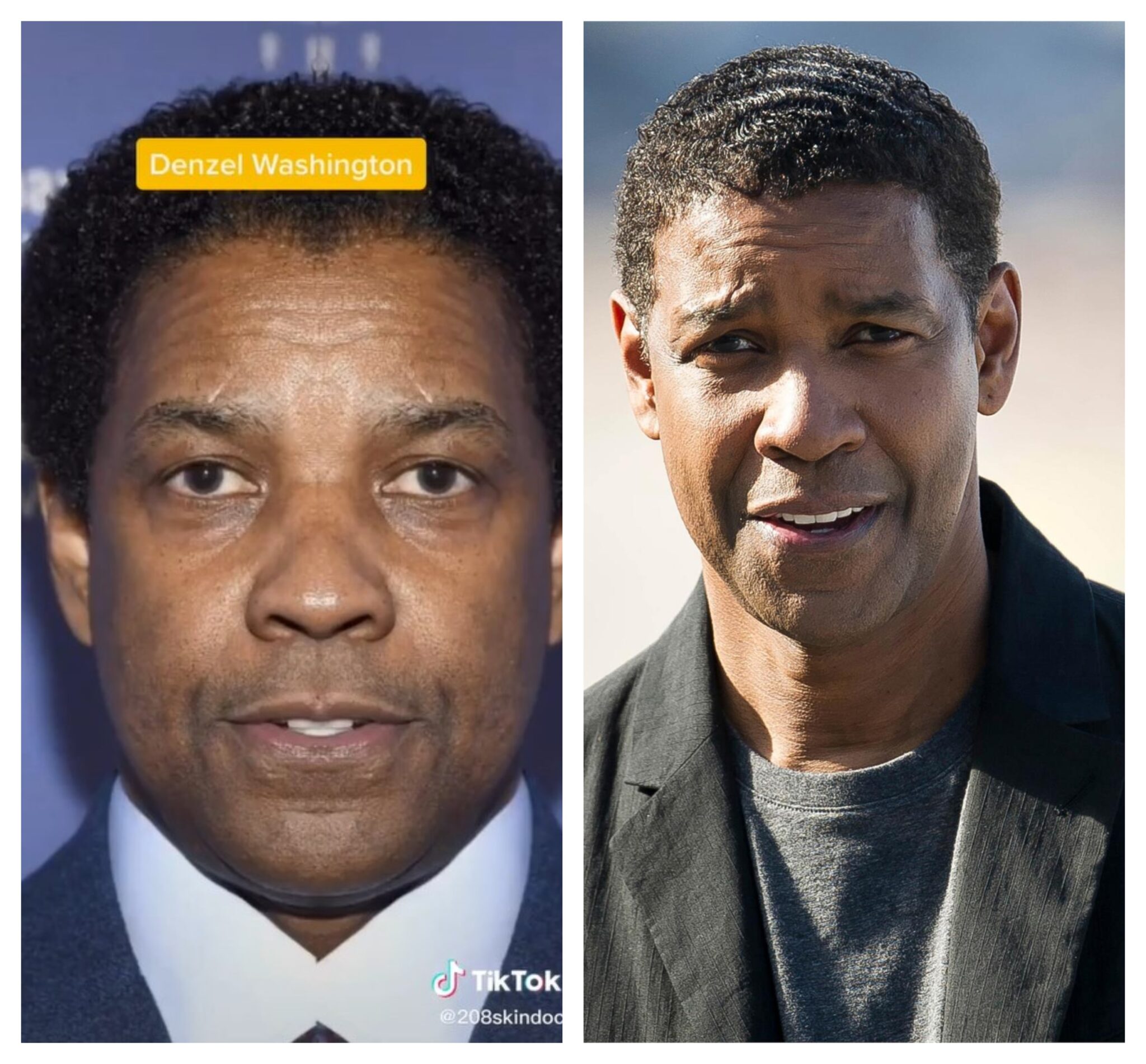 A Dermatologist Proves That Face Symmetry Does Not Equal Beauty - EDM ...