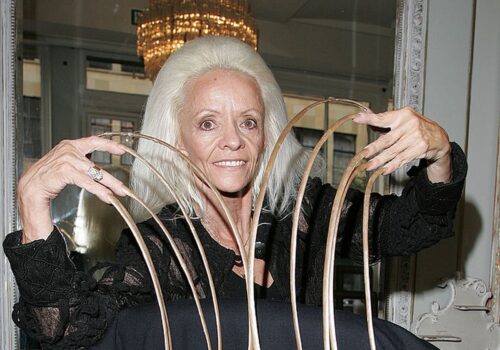 Woman With the Longest Nails Reveals How She Lost Them - EDM Chicago