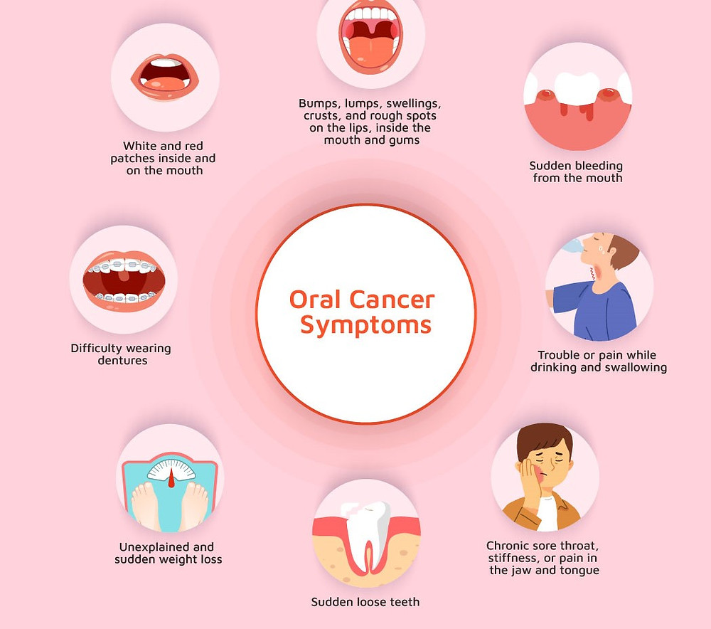 Risks Factors and Causes of Oral Cancer - EDM Chicago