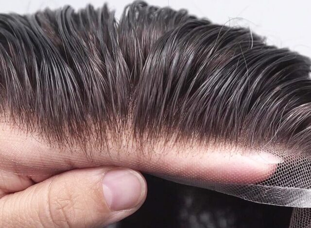 Men's Toupees vs. Hair Transplants: Which is the Right Choice for You ...